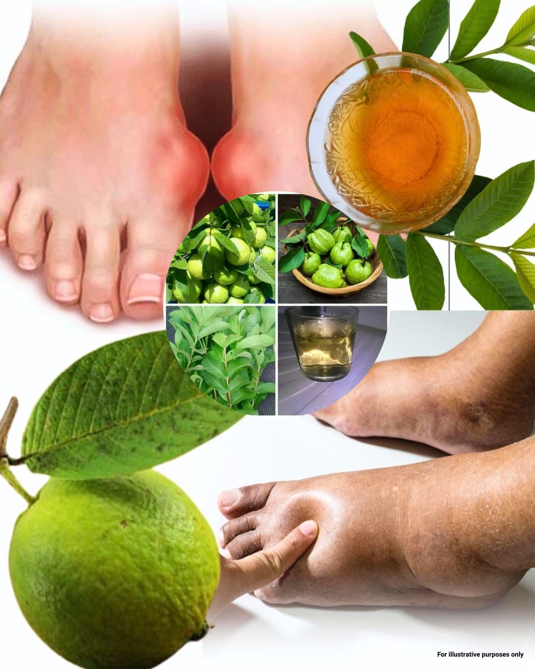 Guava Leaves for Water Retention: A Natural Remedy That Actually Works