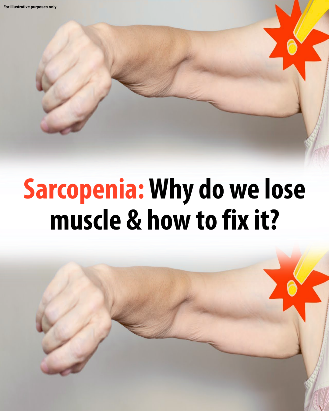 Sarcopenia: Causes of Muscle Loss and Solutions