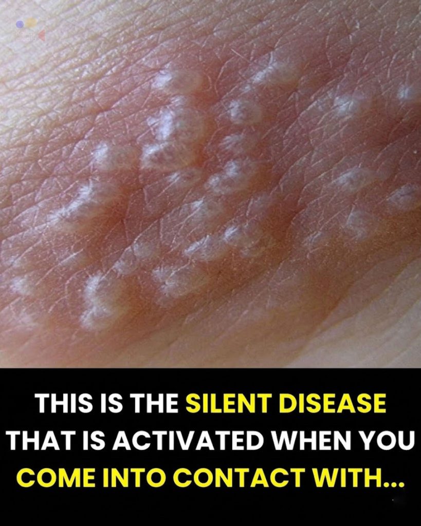 The Hidden Truth About This Silent Illness That Can Strike Suddenly